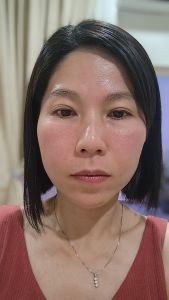 Secret DUO review: Tried this microneedling treatment and it shaved ...