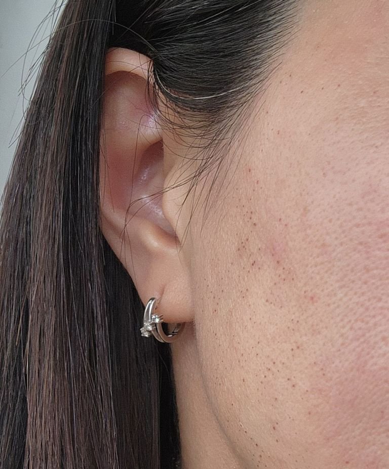 Secret DUO review: Tried this microneedling treatment and it shaved ...